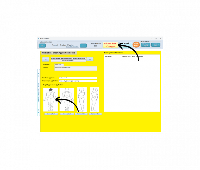 Adding Cream Charts to Care Control – Care Control Learning Hub