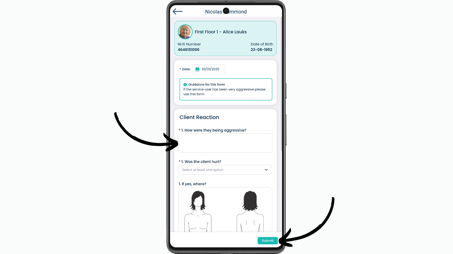 Utilising Single Custom Form Workflows – Care Control Learning Hub